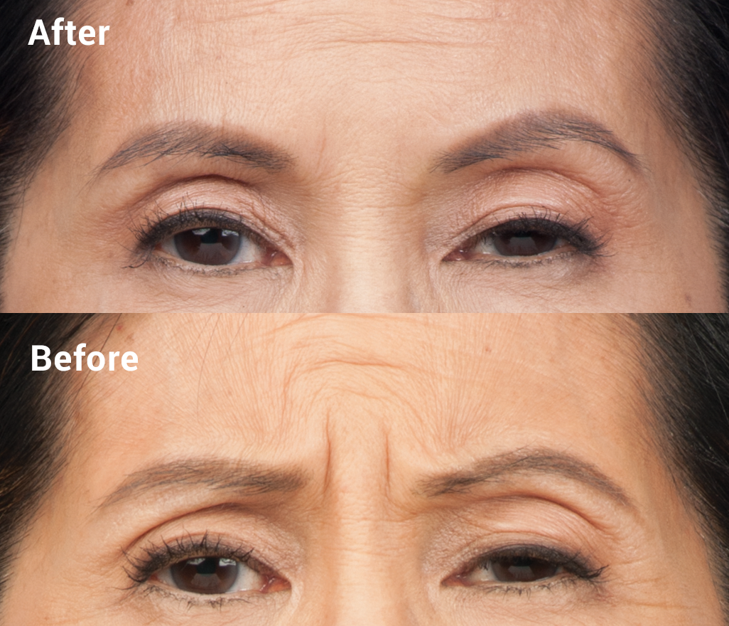 Skinwell Dermatology: Dr. Ava Khosraviani, MD, FAAD - Encino, CA